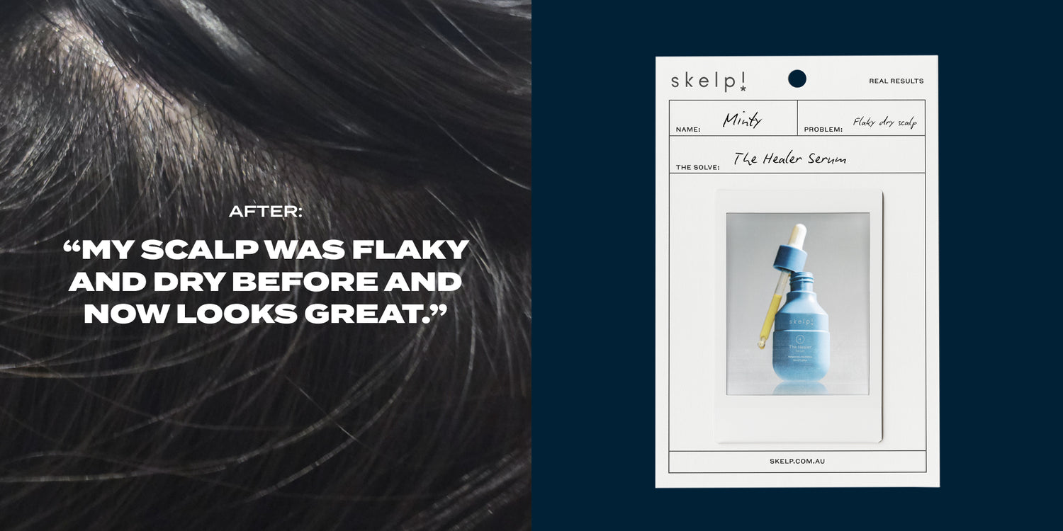 skelp! Good Scalp. Good Health. Good Hair.