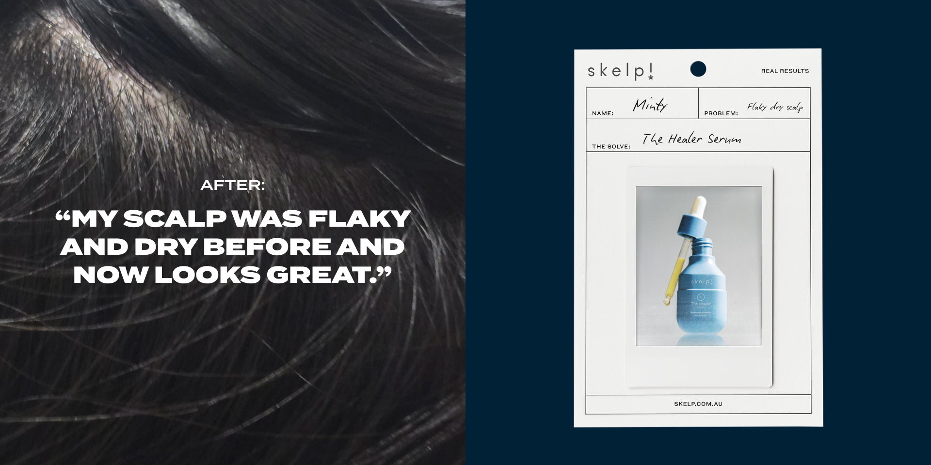 skelp! Good Scalp. Good Health. Good Hair.