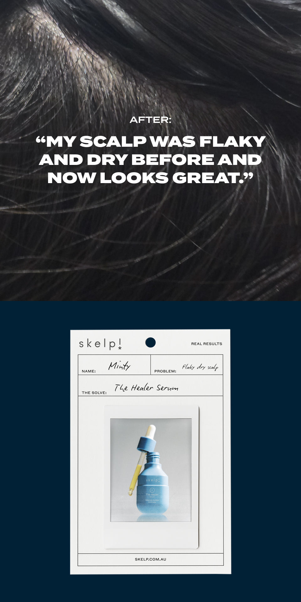 skelp! Good Scalp. Good Health. Good Hair.